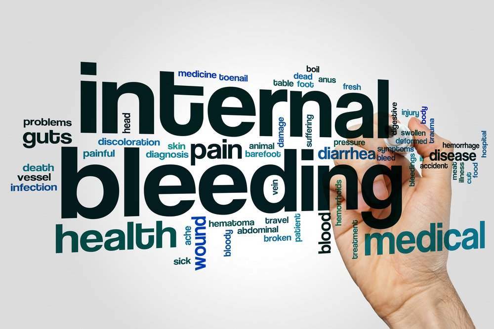 Internal Bleeding Hand