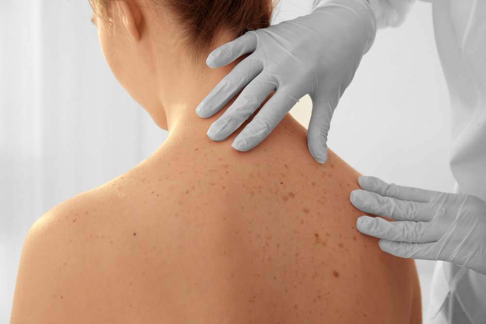 What to Do if You Get Roundup on Your Skin