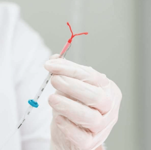 Copper IUD Side Effects | Anidjar & Levine