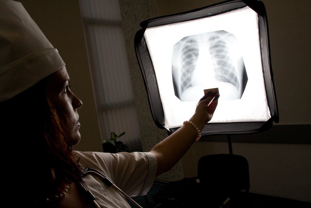 Broken Ribs Accident Lawyer in Miami Beach | No Win, No Fee. Available 24/7